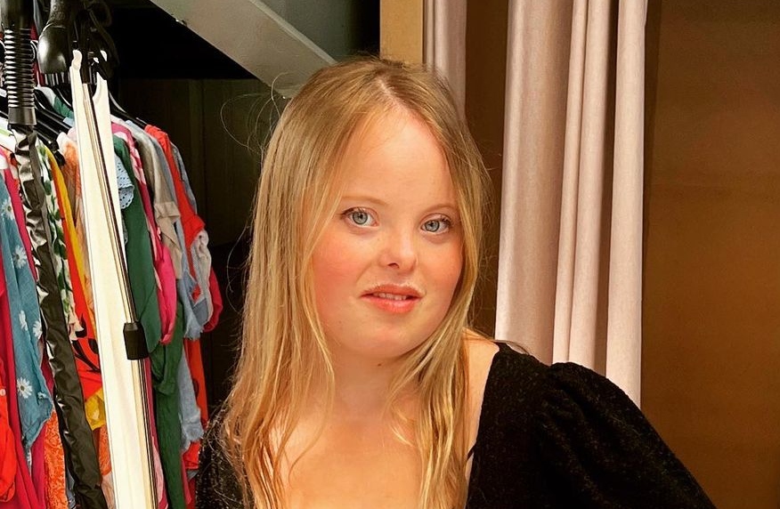 Beth Matthews: Το 23χρονο μοντέλο με σύνδρομο Down «αλλάζει το πρόσωπο ...