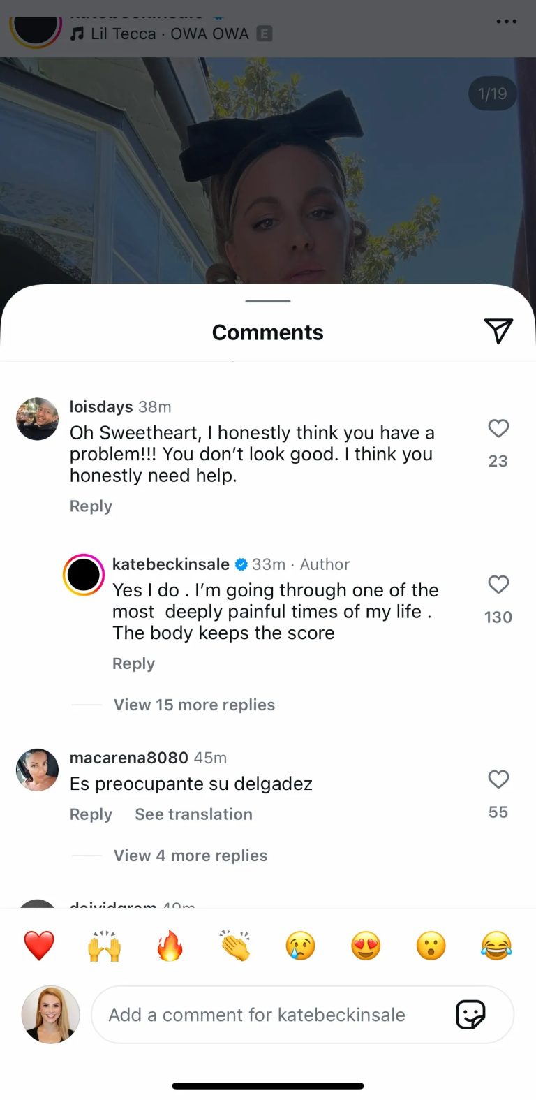 Kate Beckinsale: Ανησυχία για τη δραματική απώλεια βάρους